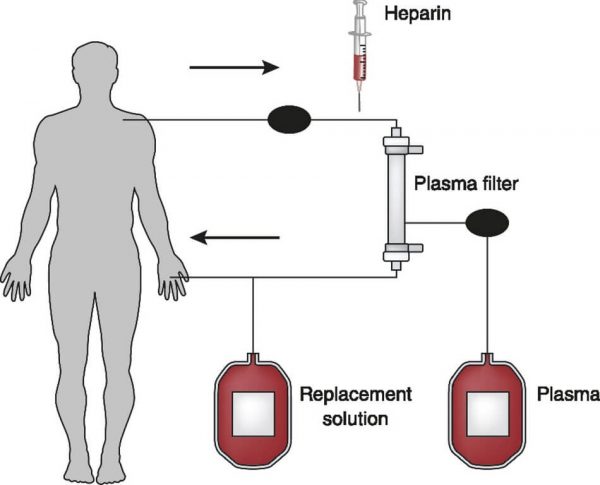 Balo Disease Symptoms, Diagnosis and Best Treatment in 2021 - Be Your ...