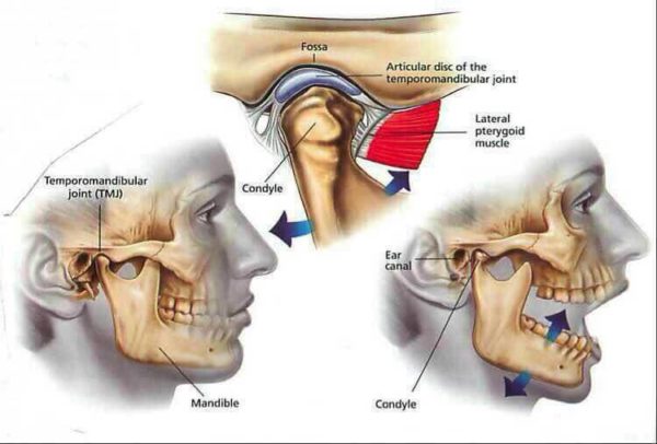 How 4 TMJ Relief Exercises Quickly Treat Jaw Pain Causes and Symptoms ...